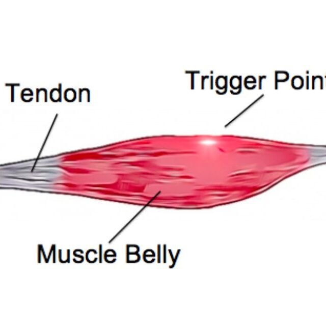 What Are Muscle Bellies? Complete Guide for Lifters and Fitness ...